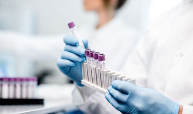 Un kit permite diagnosticar la sepsis en tres horas